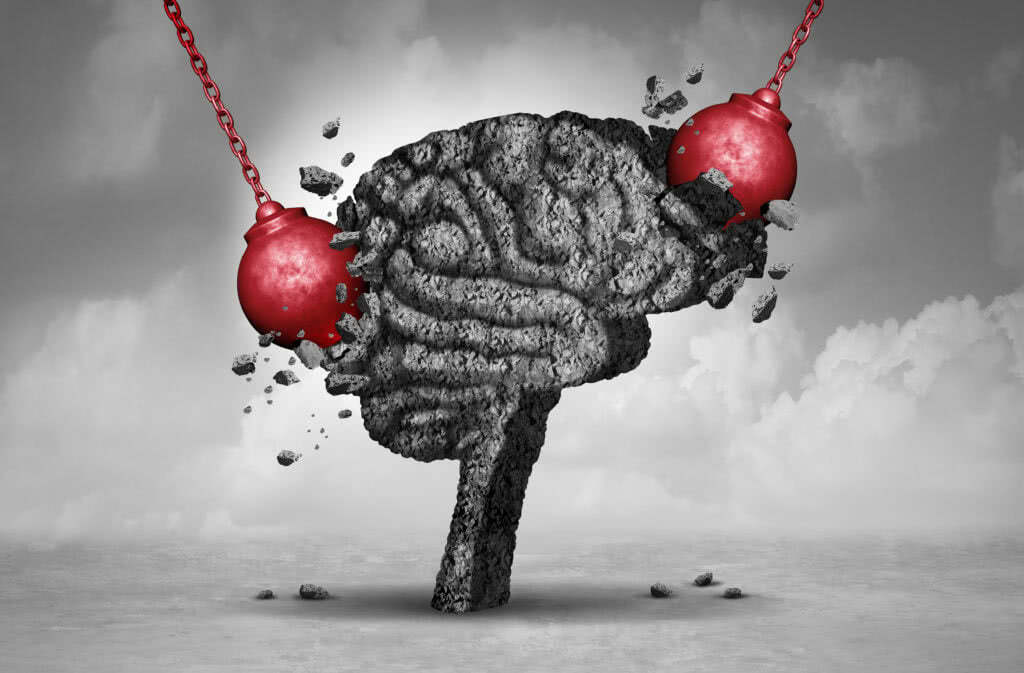 How Migraine And Mini Stroke Affect Stroke Risk HealthCurrents