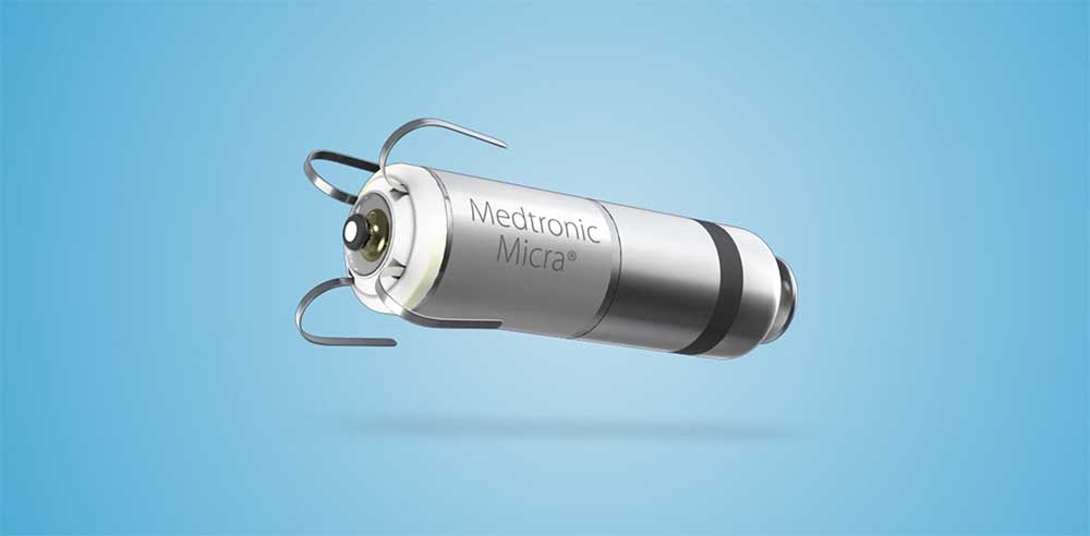 World’s Smallest Pacemaker: Micra Transcatheter Pacing System (TPS ...